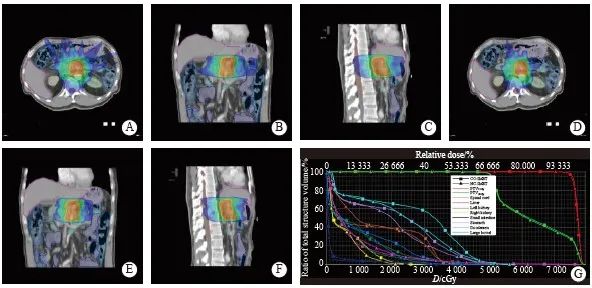 局部晚期胰腺癌75 Gy同步加量放射治疗的剂量可行性研究 - 好医术文章 - 好医术-赋能医生守护生命